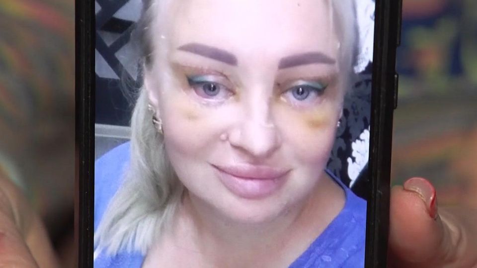 Opfer berichten aus Cherson: "Wir mussten 'Heil Putin' und 'Heil Shoigu ...