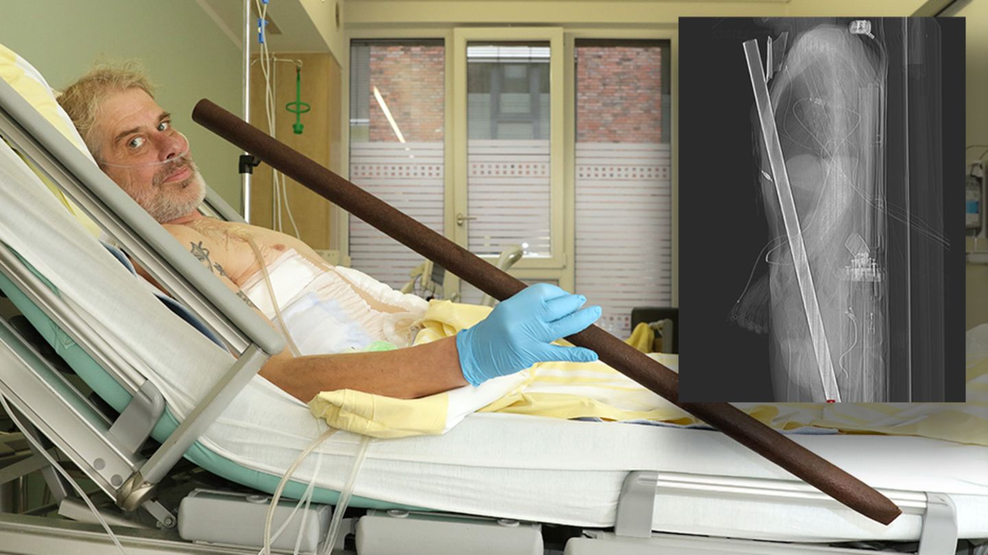 Cuxhaven: 55-year-old is pierced by a fence pole and survives - 24 ...