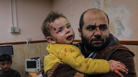 Gaza: Al-Aksa-Krankenhaus ist das Morphium ausgegangen | STERN.de