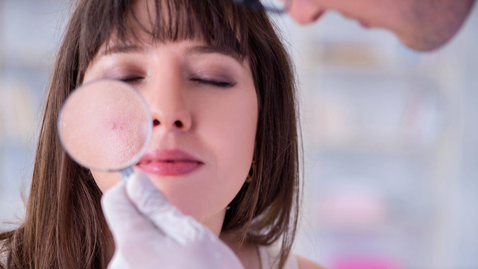 Akne: Sechs wirksame Tipps von Stiftung Warentest gegen Pickel | STERN.de