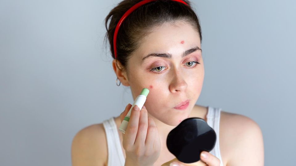 Akne: Sechs wirksame Tipps von Stiftung Warentest gegen Pickel | STERN.de