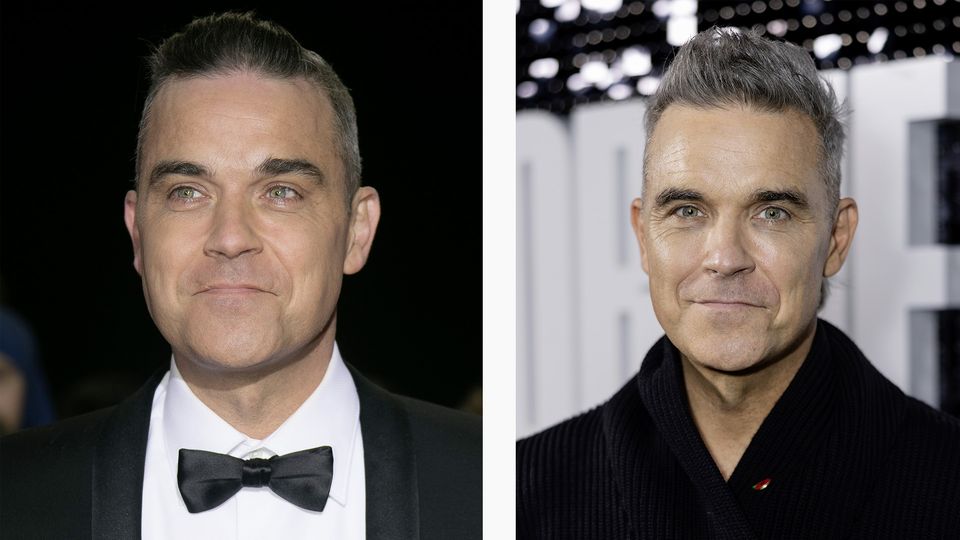 Hängendes Hollywood: Die unschönen Folgen der Abnehm-Spritze Ozempic ...