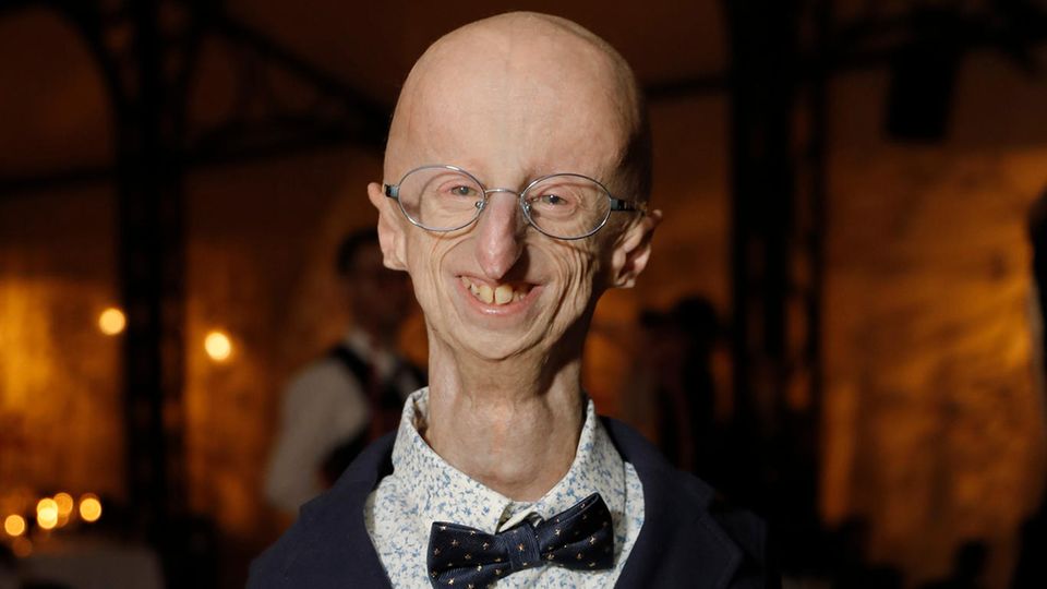 Sammy Basso gestorben: Progerie-Aktivist wurde 28 Jahre alt | STERN.de