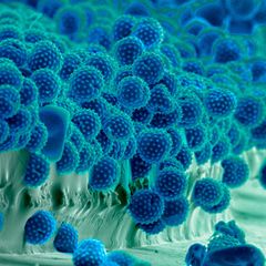 Pollenflug aktuell: Kalender und Karte zeigen, wo heute Pollen sind ...