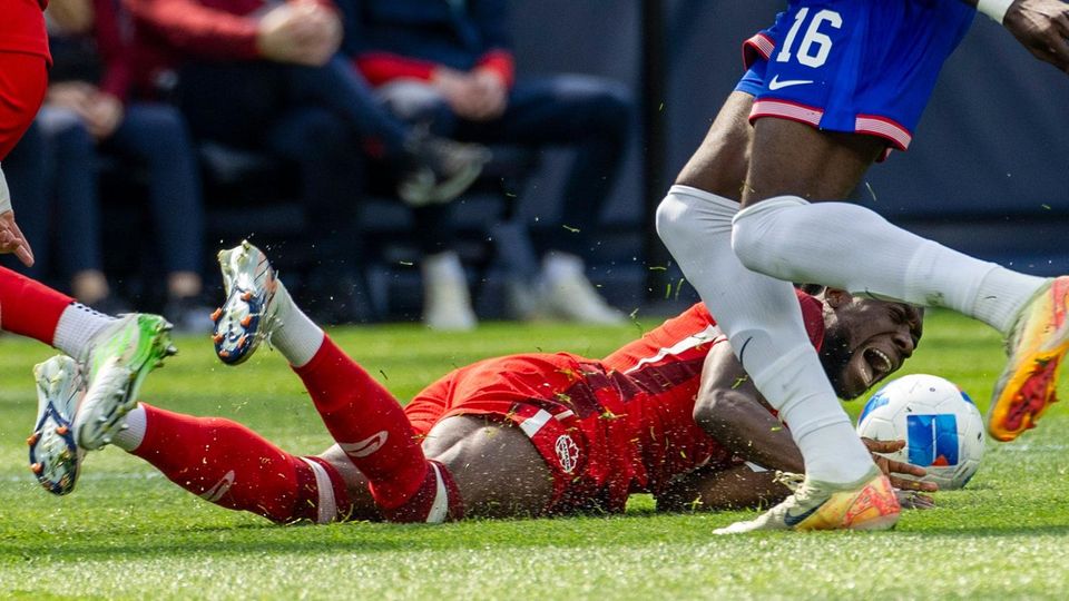 FC Bayern: Zwei schwere Verletzungen machen dem Rekordmeister schaffen ...