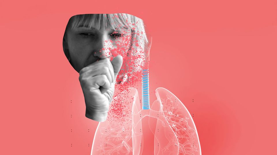 Diagnose: Husten und blutiger Auswurf - warum ist die Luftröhre blau ...