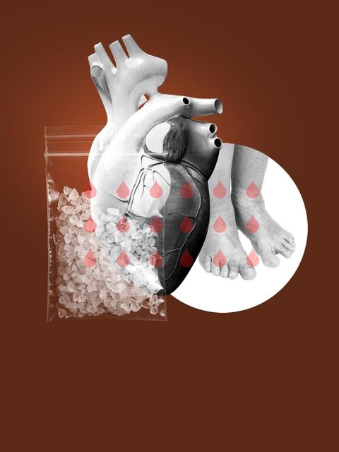 Illustration: Herz, geschwollene Füße und ein Tütchen mit Drogen