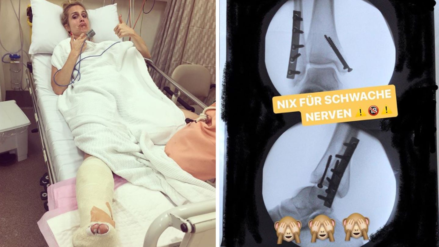 Dschungelcamp-Reporterin im Krankenhaus - der Horror-Sturz von Susanna ...