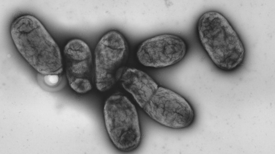 USA: Junge erkrankt an Beulenpest - erster Fall seit 26 Jahren | STERN.de