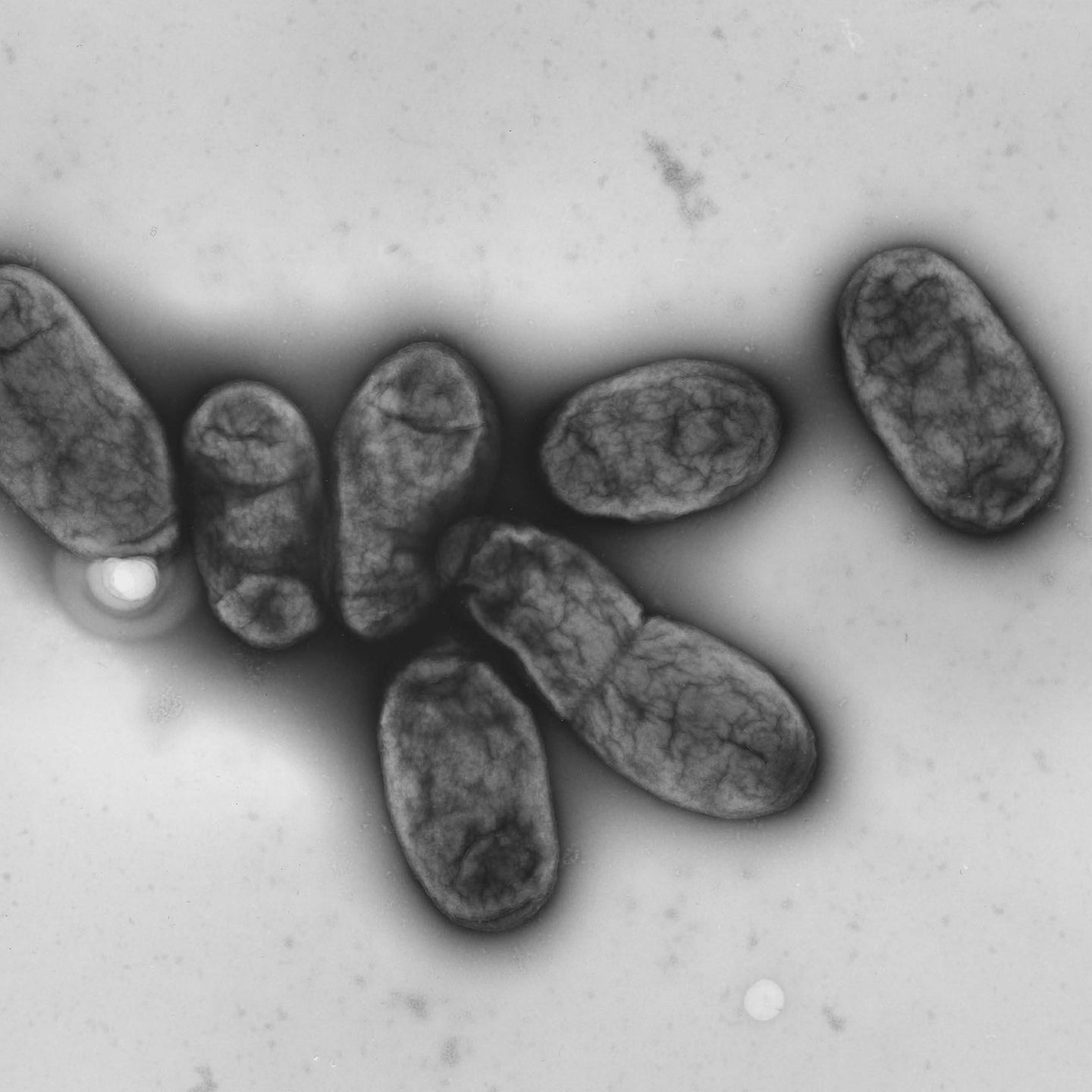 Beulenpest Symptome Mittelalter