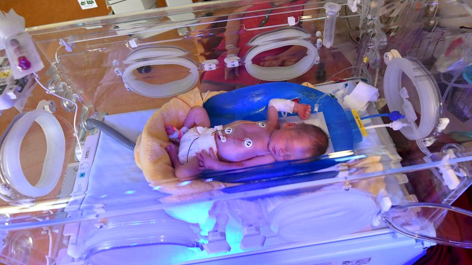 Brutkasten: Kann diese Innovation eine Mutter vertreten? | STERN.de