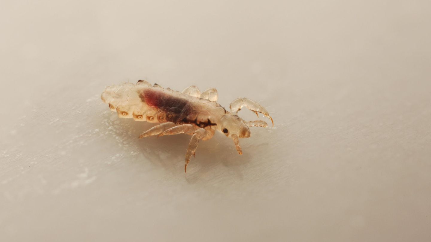 Stiftung Warentest prüft Mittel gegen Läuse: Diese Produkte helfen ...
