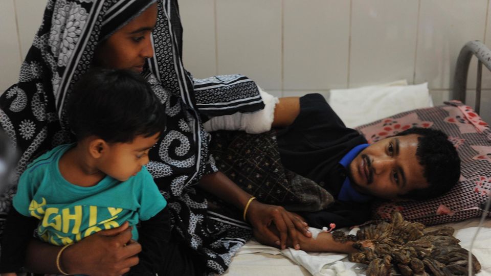 "Baummann" in Bangladesch: "Habe die Ärzte gebeten, meine Hände ...