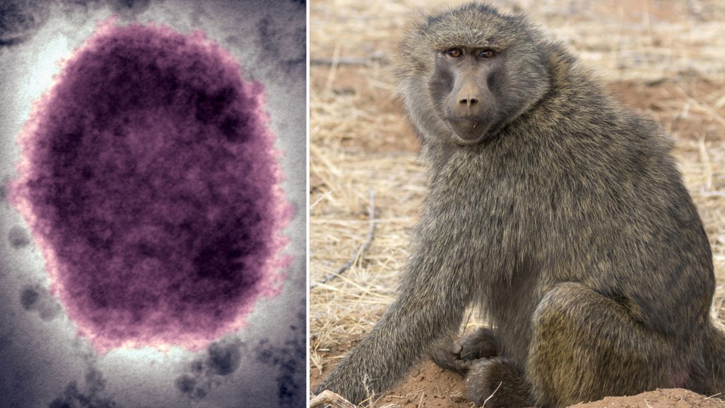 Affenpocken: Brite infiziert sich in Afrika mit dem Virus | STERN.de