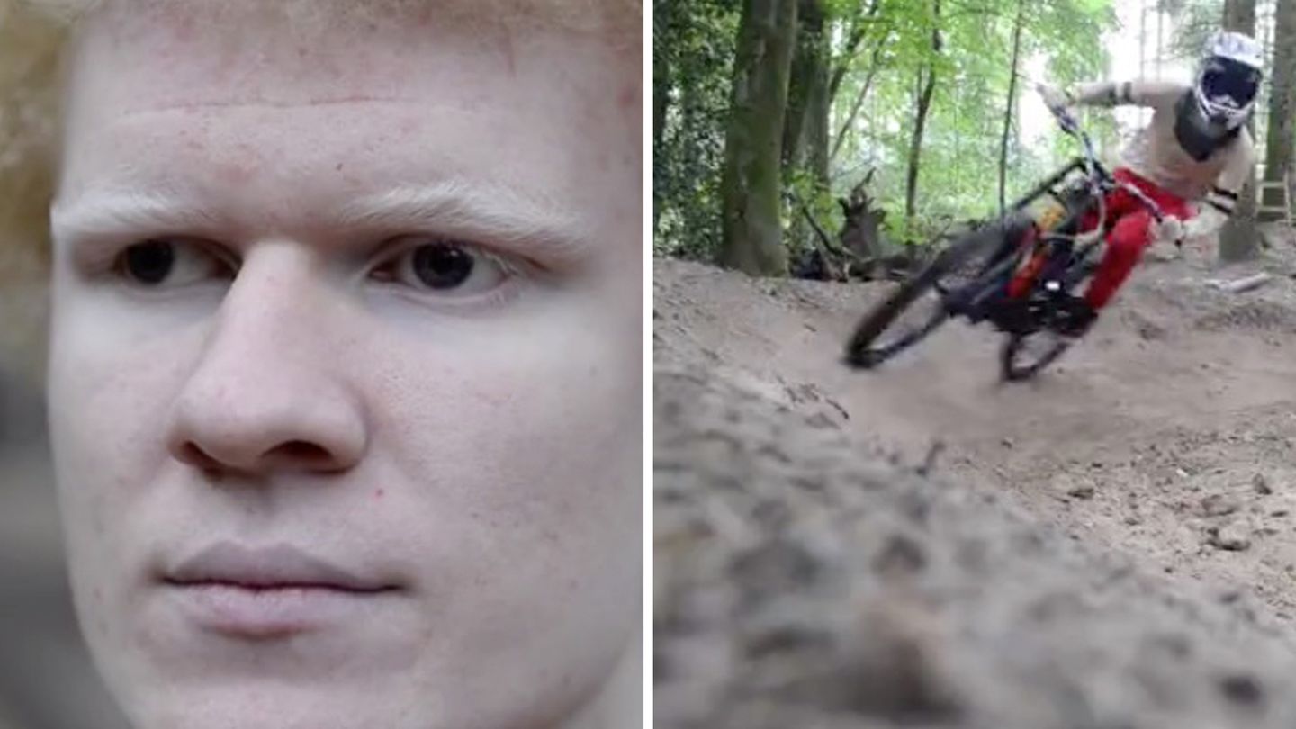 Video: Blinder Mountainbiker konkurriert furchtlos im Sport | STERN.de
