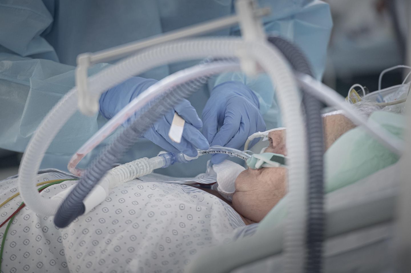 Erklär-Video: So werden Covid-19-Patienten auf der Intensivstation ...